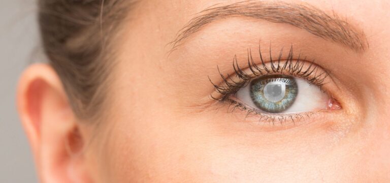 Leucoma corneal: ¿qué es y cómo tratarlo? | Blog D'Opeluce